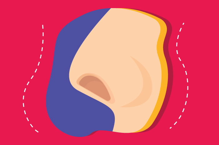 Gejala Umum dan Penyebab Rhinitis Alergi