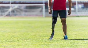 Harus Tahu, Pertolongan Pertama pada Korban Amputasi